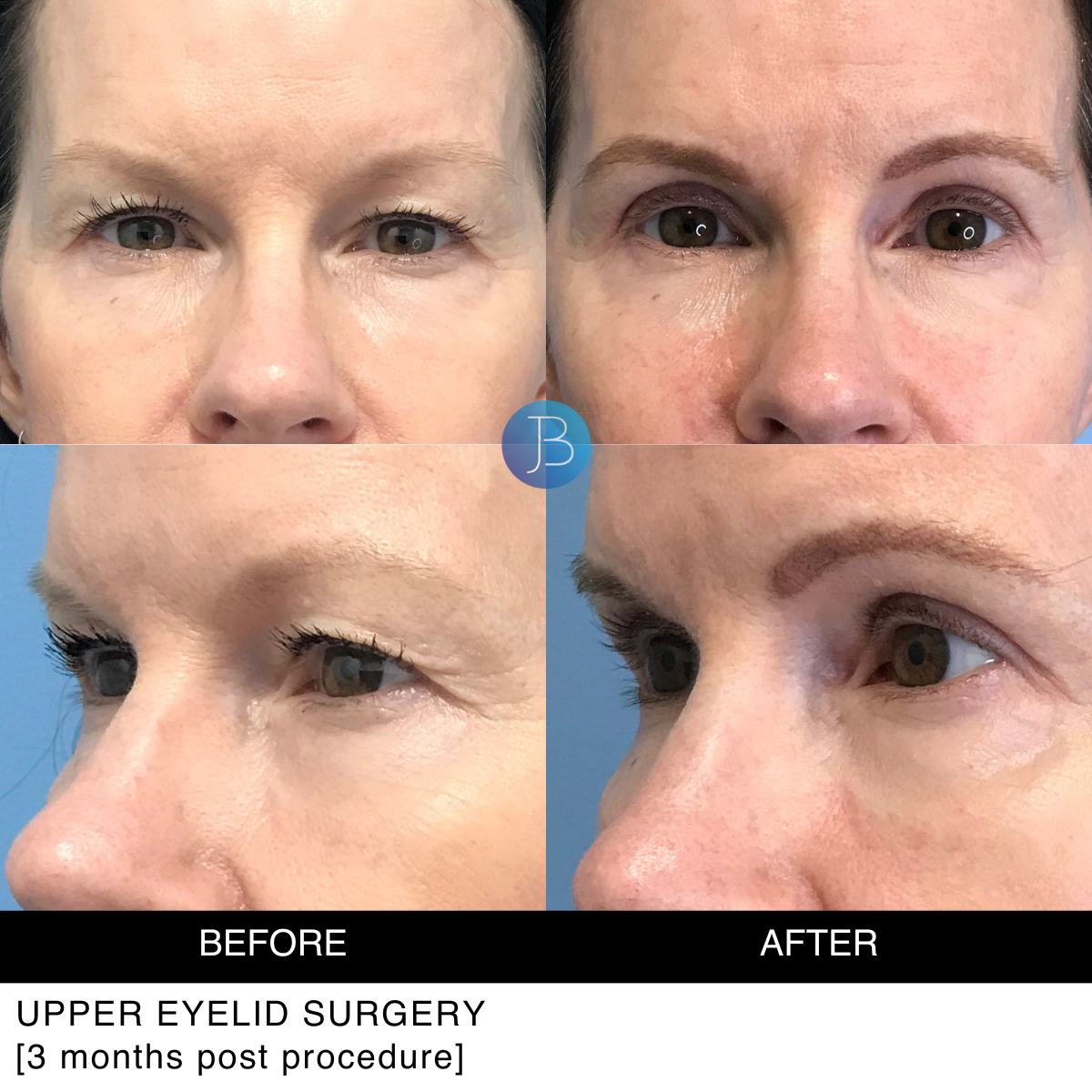 Gallery - Jacob Bloom, MD
