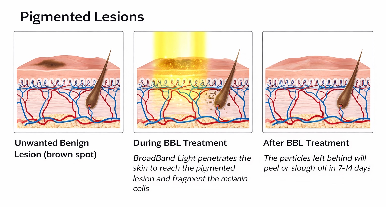 New Light Therapy Skincare Treatments - Jacob Bloom, MD
